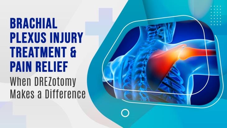 Brachial Plexus Injury Treatment & Pain Relief: When DREZotomy Makes a ...